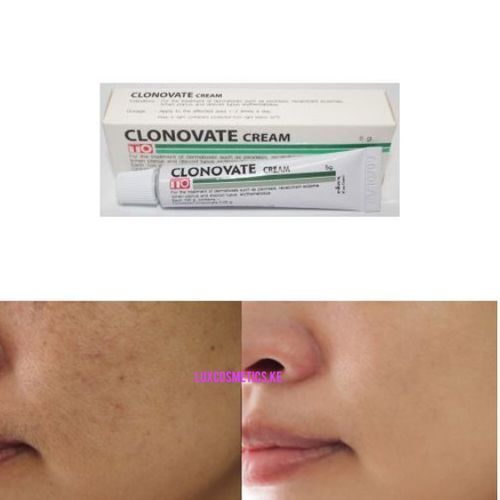 Clonovate Skin Lightening Cream-15g Very Effective.. @ Best Price ...