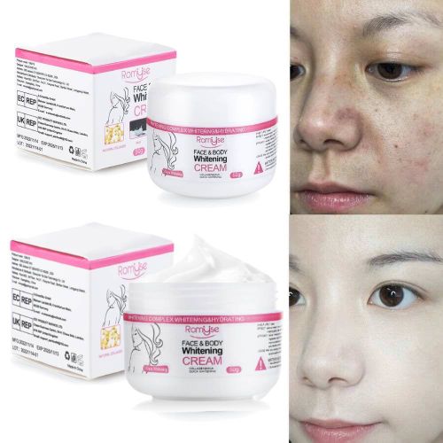 Generic Face Whitening Cream For Dark Skin Spots Scar Best Price Online Jumia Kenya